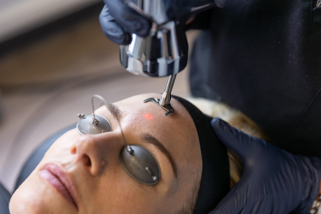 Profractional Laser Treatments Denver CO - Skin Rejuvenation
