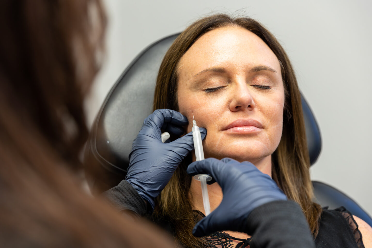 Sculptra Injection Treament Near Denver CO - Collagen Stimulation