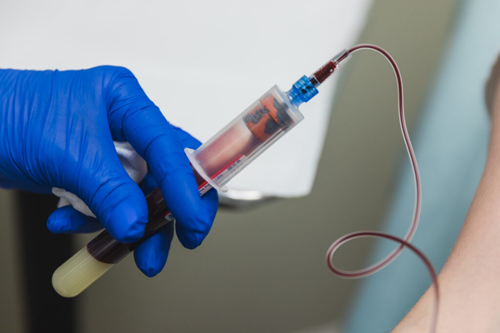 Platelet Rich Plasma Therapy Denver CO - PRP Dermatology