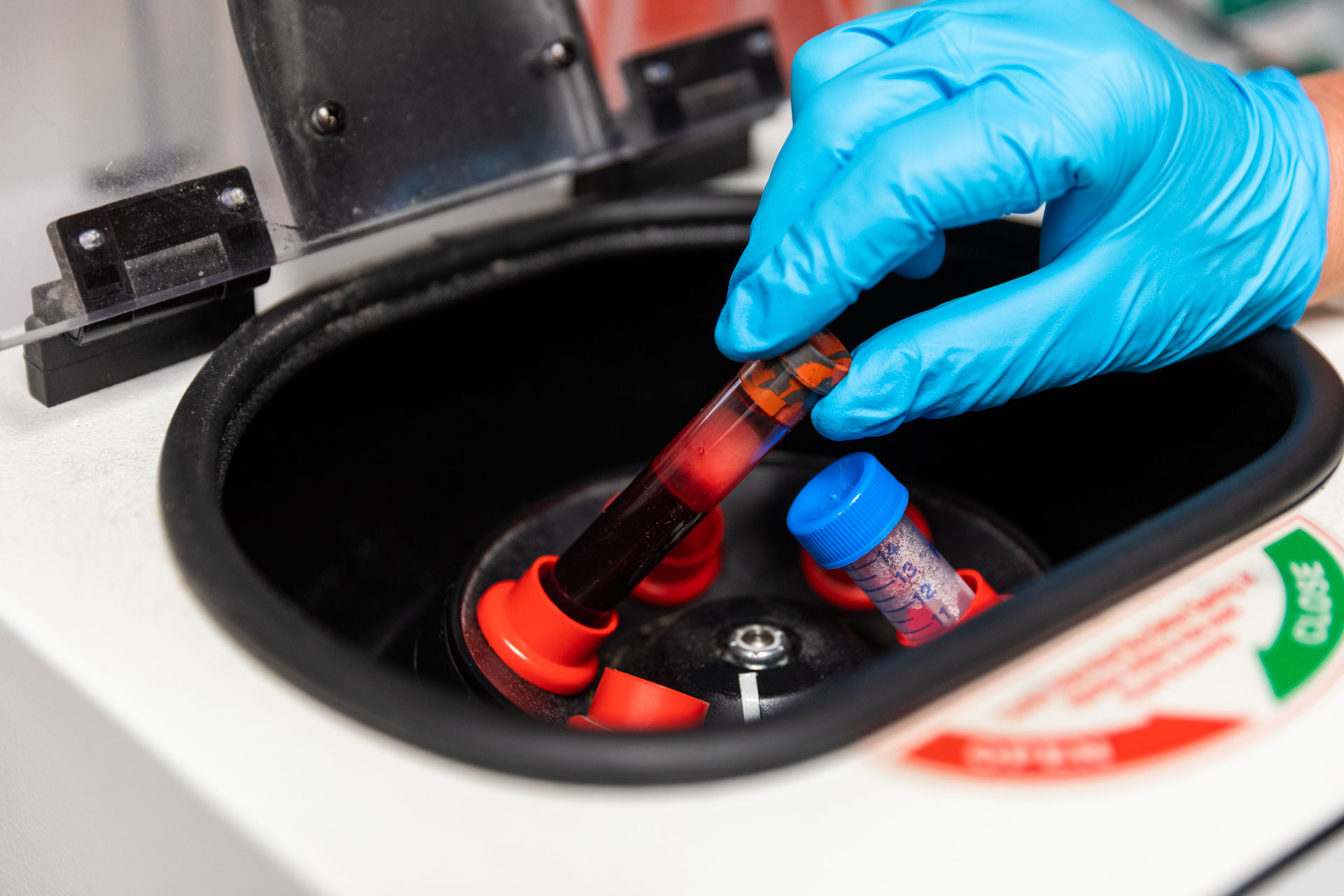 Platelet Rich Plasma Therapy Denver CO - PRP Dermatology